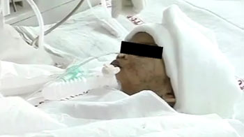 Baby Falak, age two, dies of heart attack in hospital in Delhi